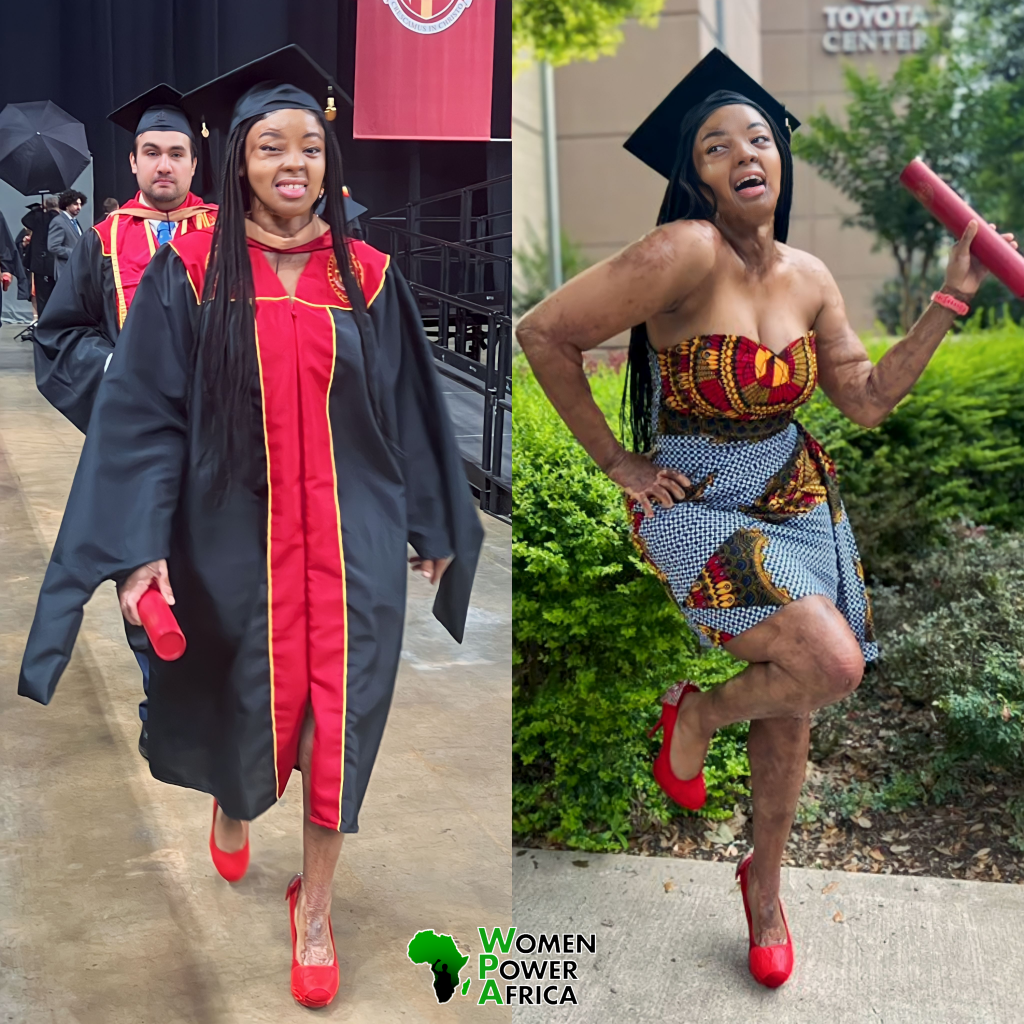 Kechi Okwuchi: From a horrific plane crash survivor to an MBA graduate with distinction. - Women ...